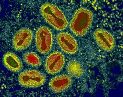 WHO recommends new name for monkeypox disease - VICTORIA MEDIA